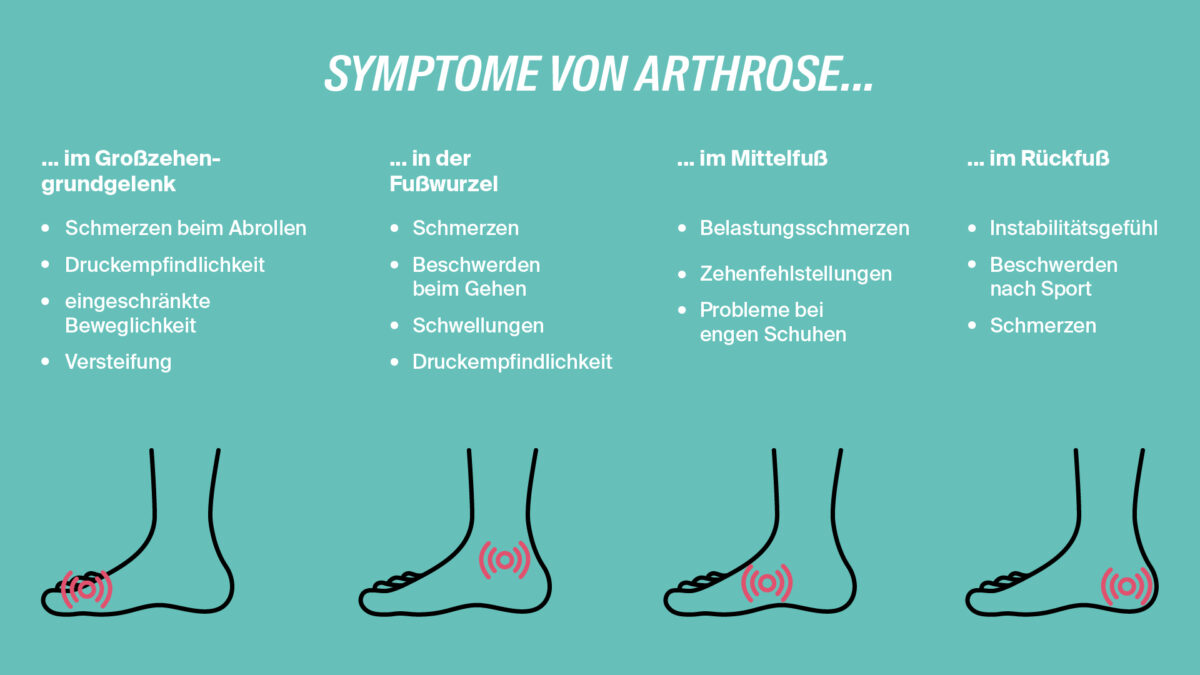 Arthrose im Fuß: Erkennen und behandeln!
