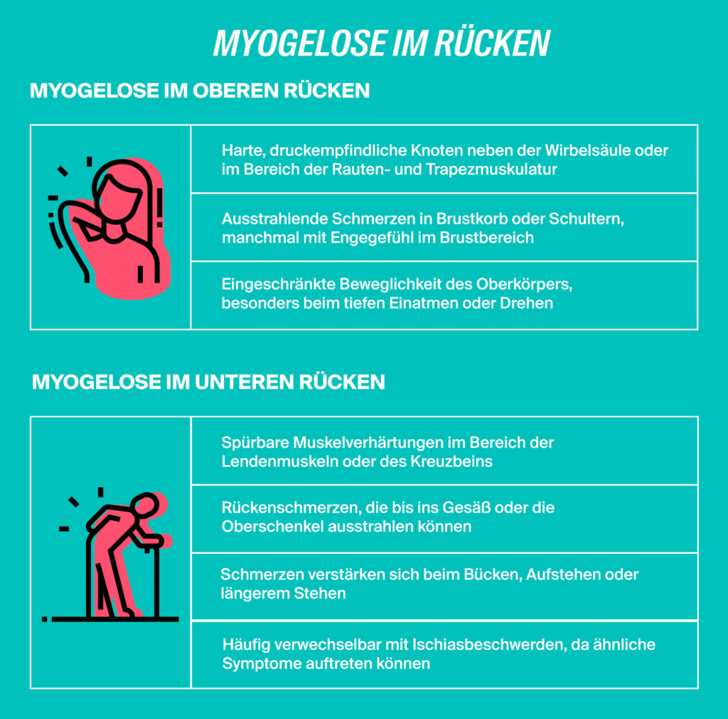 Myogelose: Muskelverhärtungen erkennen & behandeln